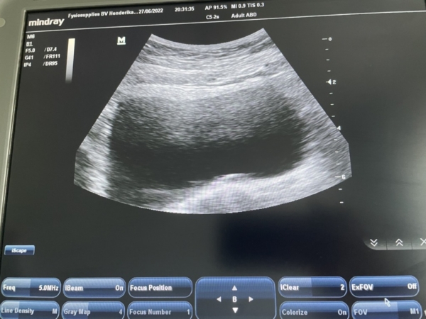 Echografie - Kinepraktijk De Bloesem